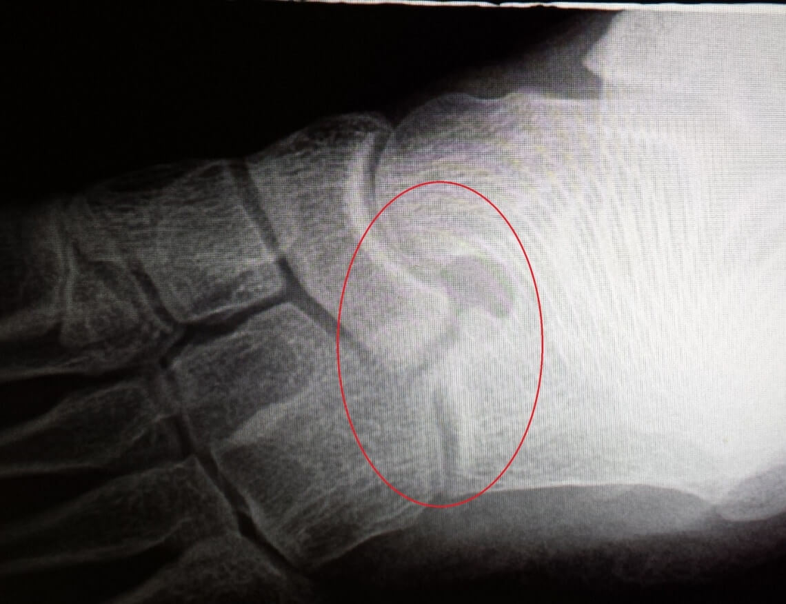 Coalition - OC Podiatry