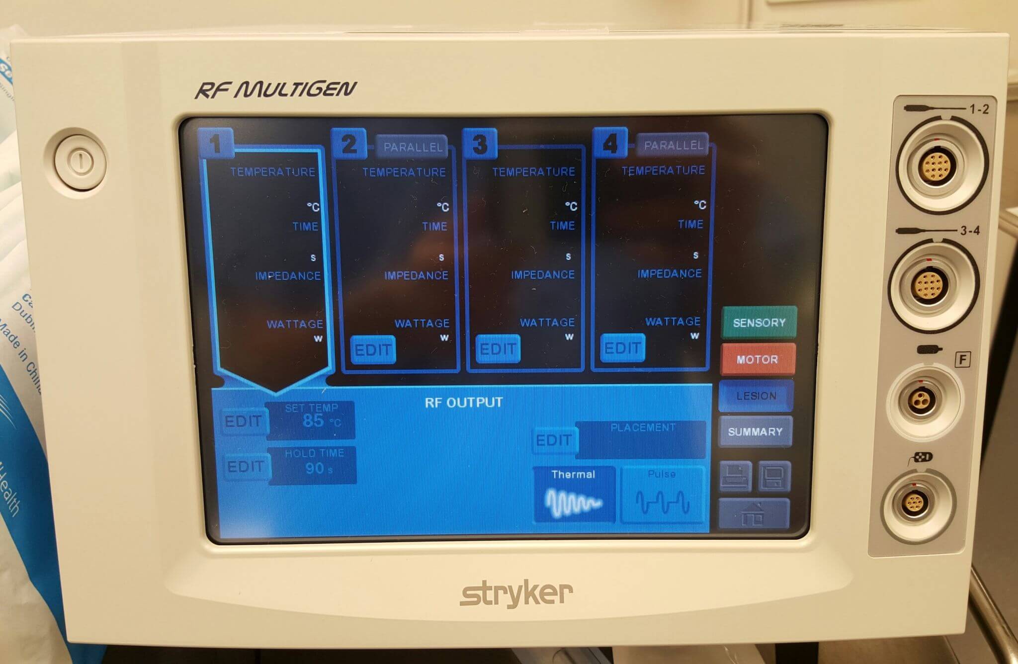 Radiofrequency Ablation